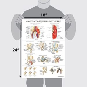 Palace Learning Laminated Anatomy and Injuries of the Hip Poster - Hip Joint Anatomical Chart - 18" x 24"