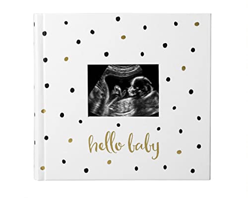 Pearhead Hello Baby Photo Album, Baby Book Keepsake for New and Expecting Parents, Gender-Neutral Baby Accessory, Holds 200 Photos, Black and Gold Polka Dot