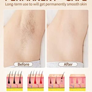 GERCY Laser Hair Removal for Women Permanent, Painless At-Home IPL Hair Removal Device Upgraded to 999,999 Flashes, 5 Level Energy Adjustable & 2 Flash Modes for Beautify Skin, Face, Body, Bikini