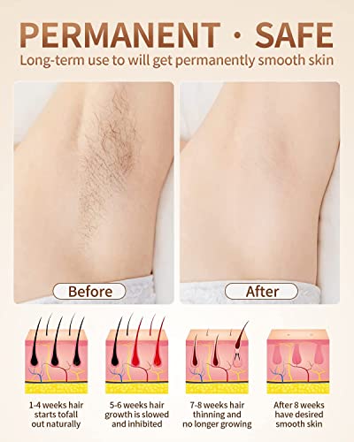 GERCY Laser Hair Removal for Women Permanent, Painless At-Home IPL Hair Removal Device Upgraded to 999,999 Flashes, 5 Level Energy Adjustable & 2 Flash Modes for Beautify Skin, Face, Body, Bikini