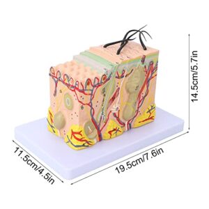 Skin Model, 35X Enlarged Human Skin Structure Anatomical Model 3D Enlarged Skin Model for Science Classroom Study Display Teaching Medical Model