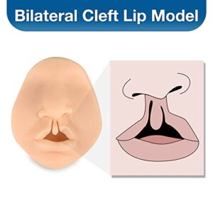 Ultrassist Bilateral Cleft Lip Model, Cleft Lip Suture Training Simulator for Medical Students, Education, Display