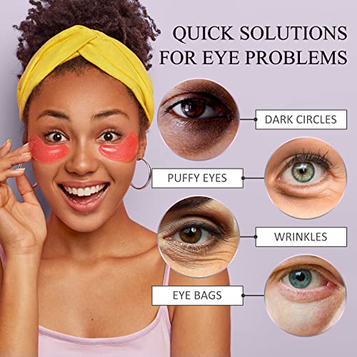 SHVYOG Under Eye Patches, Under Eye Mask for Dark Circles and Puffiness, Eye Gel Pads for Puffy Eyes, Anti Aging Eye Bags Treatment for Women, Pearl, Green Tea, Camellia, Marine Collagen, Lavender