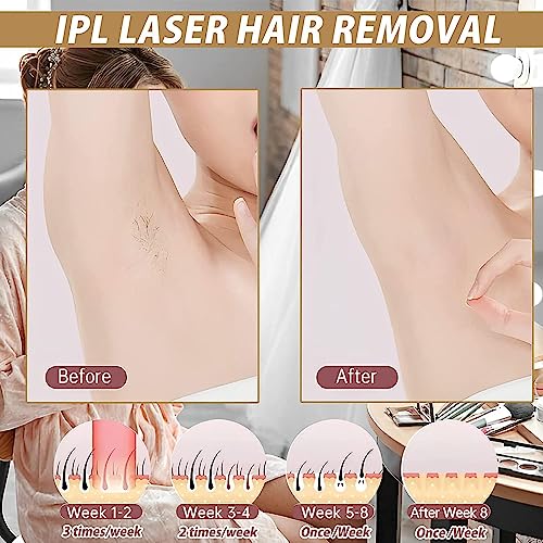 Laser Hair Removal, Permanent Hair Removal Device, Painless At-Home IPL Hair Removal for Women and Men for Face Armpits Legs Arms Bikini Line