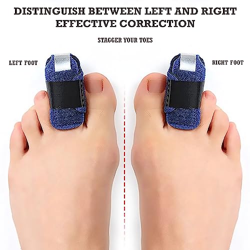 2 Pack Toe Splint,Toe Straightener for Hammer Toe, Bent Toe, Claw Toe, Crooked Toe, Curled Toe, Toe Brace, Broken Toe Splint, Hammer Toe Corrector, Toe Wrap to Align and Support Toe (Blue)