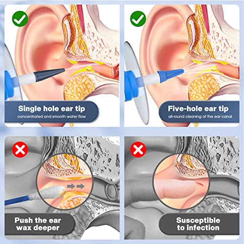 Ear Wax Removal, Electric Ear Cleaning Kit with Light, Ear Irrigation Kit with 4 Pressure Modes, Safe and Effective Ear Flush Kit with Ear Cleaner - Includes Basin, Towel & 15 Tips