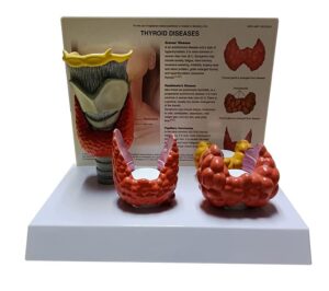 kh66zky thyroid anatomy model - thyroid nodule model - for science classroom study display thyroiditis mastoid cancer teaching medical model