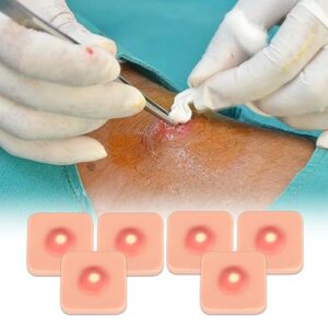 Ultrassist Abscess I&D Incision and Drainage Pad (6-Pack), Sebaceous Cyst Removal Trainer, Suture Practice Skin Pad for Medical Education