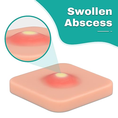 Ultrassist Abscess I&D Incision and Drainage Pad (6-Pack), Sebaceous Cyst Removal Trainer, Suture Practice Skin Pad for Medical Education