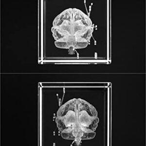 QWORK 3D Human Brain Anatomical Model, Laser Etching Crystal Glass Cube Science Gift Paperweight (LED Base not Included), 3.1(L) x2(W) x2(H) inches