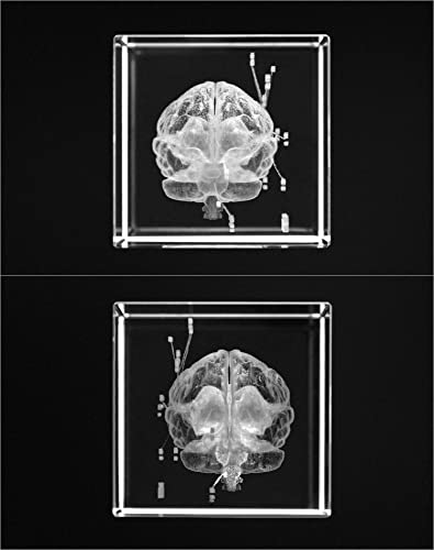 QWORK 3D Human Brain Anatomical Model, Laser Etching Crystal Glass Cube Science Gift Paperweight (LED Base not Included), 3.1(L) x2(W) x2(H) inches