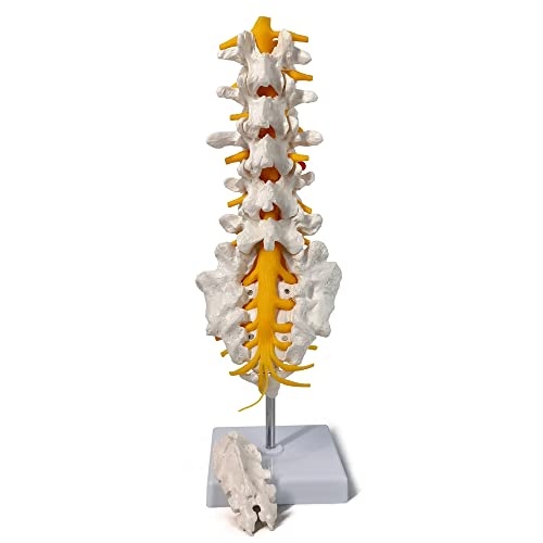 Evotech Lumbar Spine Anatomy Model with Sacrum and Spinal Nerves, Didactic Replica of Lumbrosacral Section with Nerves and A Herniated Disc at L4, Includes Base for Medical Teaching Display