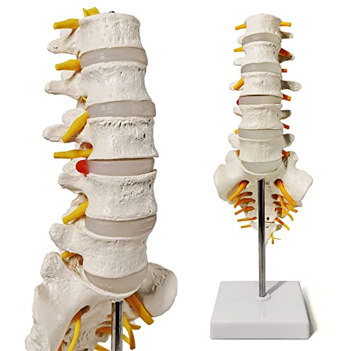 Evotech Lumbar Spine Anatomy Model with Sacrum and Spinal Nerves, Didactic Replica of Lumbrosacral Section with Nerves and A Herniated Disc at L4, Includes Base for Medical Teaching Display