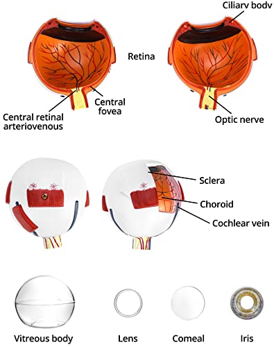 QWORK 6X Enlarged Human Eye Anatomy Model, Magnified Eyeball Model with Detachable Bracket, Anatomically Accurate Science Education Display Medical Teaching Education Human Eye Anatomical Model