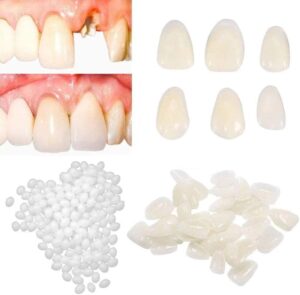 healthyare tooth repair kit-temporary fixing missing and broken tooth fake teeth, 60 piece assortment