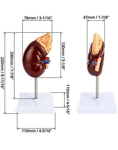 QWORK Life-Size Kidney Model, Divided into 2 Parts Showing Internal Structure A Normal Kidney Human Anatomy Replica for Doctors Office Educational Tool