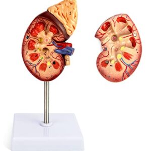 QWORK Life-Size Kidney Model, Divided into 2 Parts Showing Internal Structure A Normal Kidney Human Anatomy Replica for Doctors Office Educational Tool