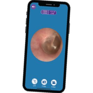 Ear View MD, Wi-Fi Ear Camera