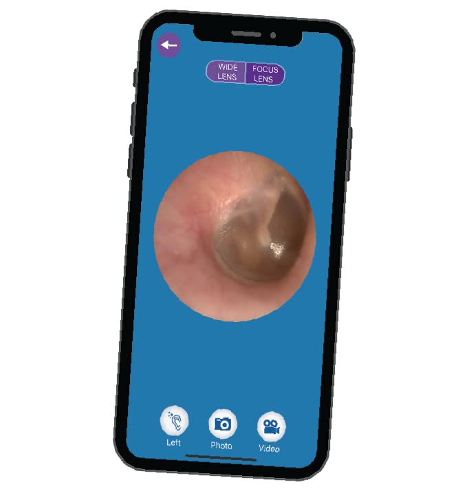 Ear View MD, Wi-Fi Ear Camera