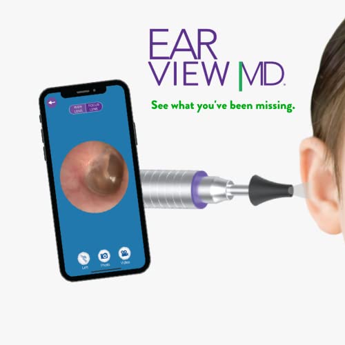 Ear View MD, Wi-Fi Ear Camera