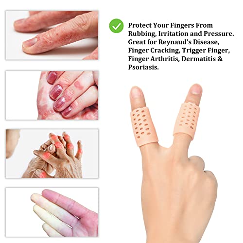 JWHOO Gel Finger Cots (Breathable, Latex Free), Finger Protectors with Hole(14PCS), Silicone Finger Gloves, Finger Covers for Hand Eczema, Trigger Finger, Finger Cracking, Finger Arthritis, Reusable.