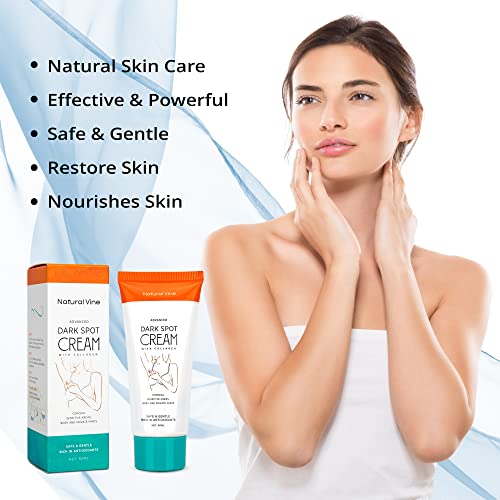 Natural Vine Dark Spot Corrector Cream, Dark Spot Remover for Body, Brightening Cream, Age Spot/Sun Spot/Brown Spot Remover, Dark Spot Cream, Instant Result, Moisturizes Armpit, Neck