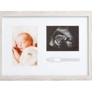 Kate & Milo Rustic Bracelet ID and Sonogram Frame, Rustic Pregnancy Keepsake Picture Frame, Gender-Neutral Nursery Décor