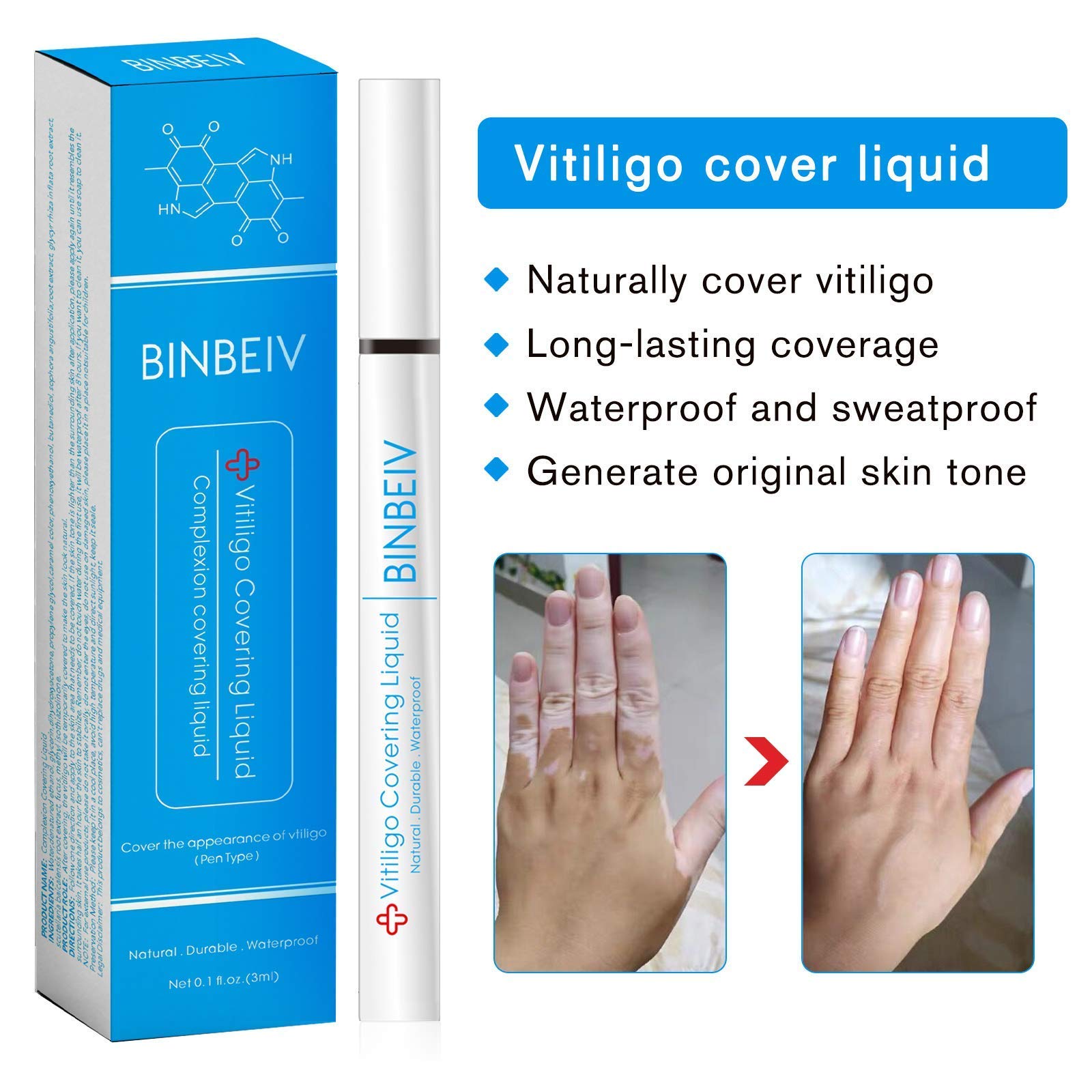 BINBEIV Vitiligo Cosmetic Camouflage Liqui, Cover appearance of Skin Depigmentation, Natural-Durable-Waterproof, Makeup Cover Waterproof, Used on face, hands and body