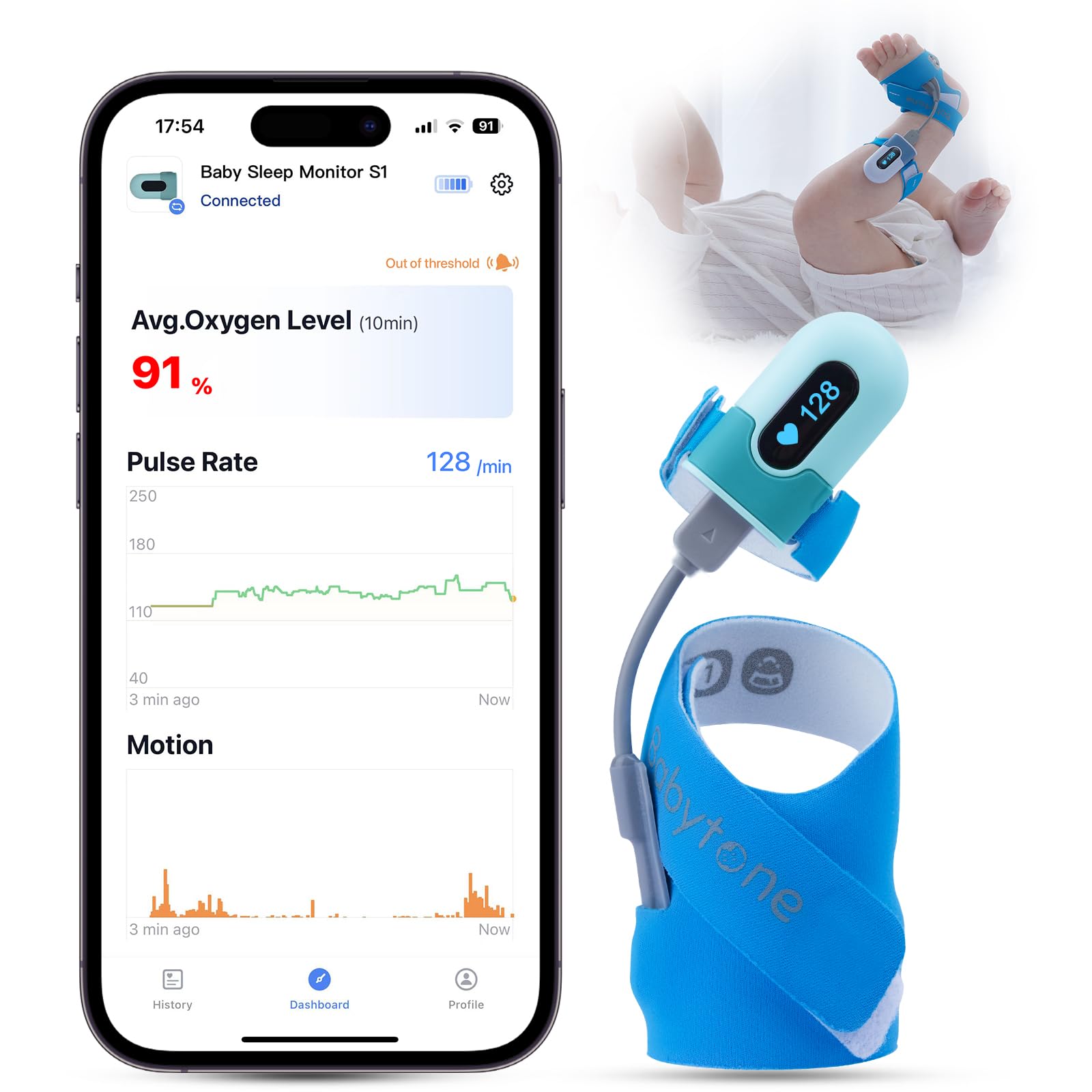 Babytone Baby Oxygen Monitor, Baby Sleep Monitor, Tracking Avg O2, Pulse Rate and Movement for Infant, Wearable Foot Monitor with Bluetooth and APP, for 0-36 Months Newborn's Sleep(New Version-Sock)