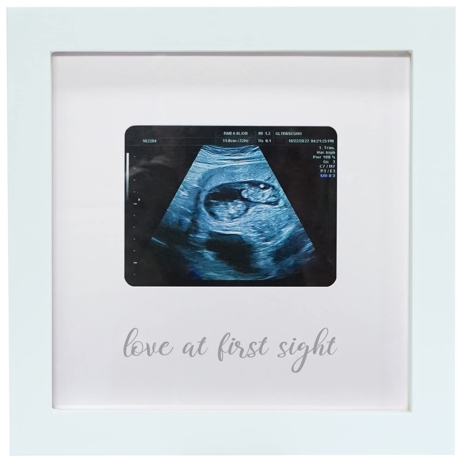 HAMUIERS Love at First Sight Ultrasound Picture Frames, Sonogram Picture Frame, Pregnancy Announcement for Grandparents, Baby Announcement Ideas Ultrasound Photo Frame Nursery Décor, White