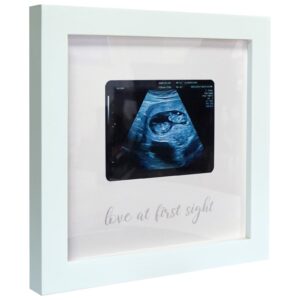 HAMUIERS Love at First Sight Ultrasound Picture Frames, Sonogram Picture Frame, Pregnancy Announcement for Grandparents, Baby Announcement Ideas Ultrasound Photo Frame Nursery Décor, White