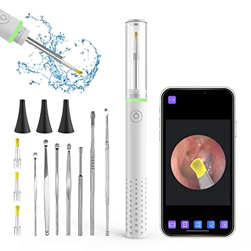 Ear Scope, Ear Wax Removal Tool Camera Wireless Otoscope 1080P Ear Cleaner Camera, Otoscope with Light Ear Wax Remover, Ear Endoscope Compatible with iPhone iPad Android