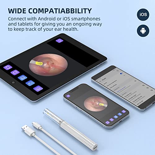 Ear Scope, Ear Wax Removal Tool Camera Wireless Otoscope 1080P Ear Cleaner Camera, Otoscope with Light Ear Wax Remover, Ear Endoscope Compatible with iPhone iPad Android