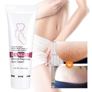 stretch mark cream, scar cream removal cream scars essence stretch mark repair cream stretch scars remove acne cream stretch mark treatment maternity repair