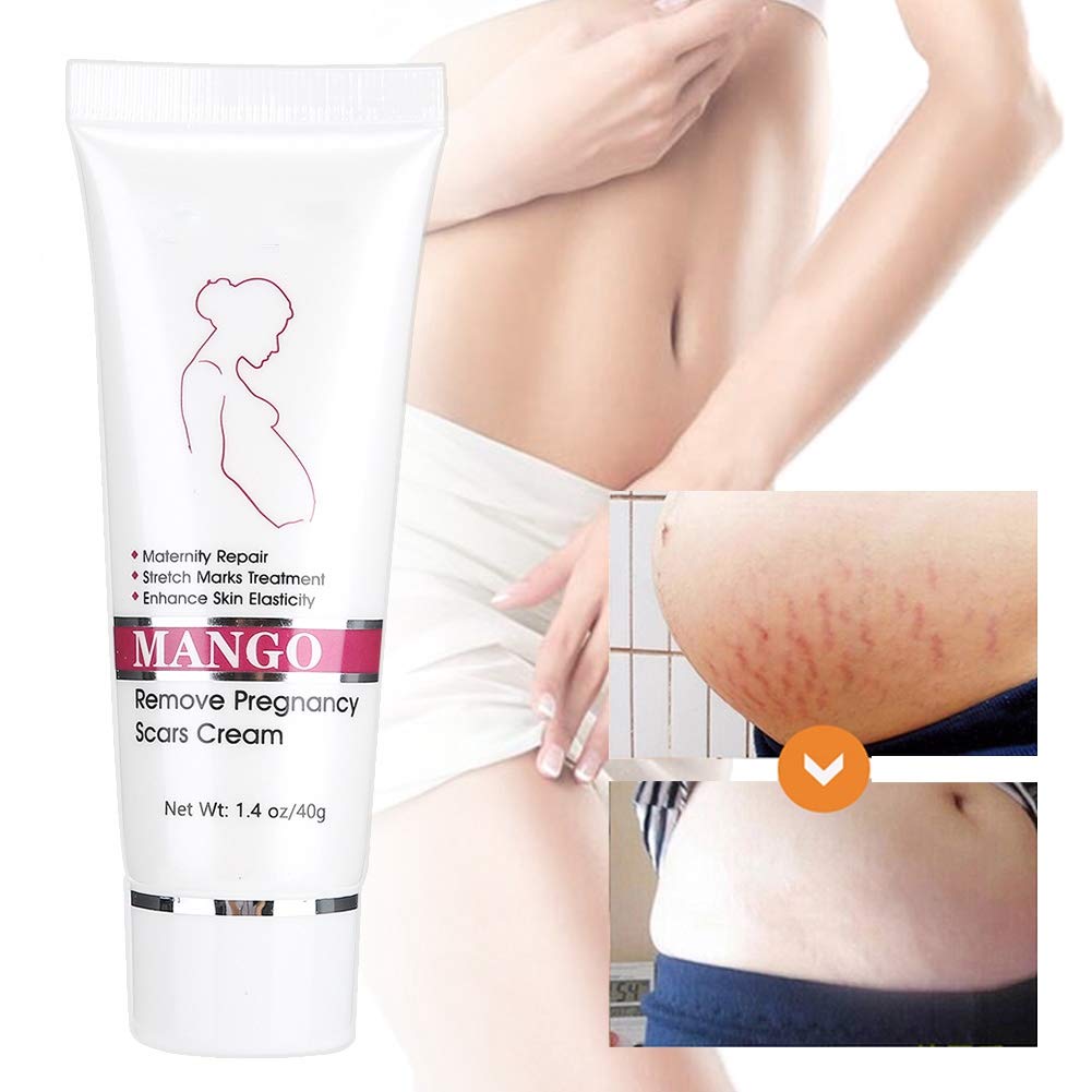 Stretch Mark Cream, Scar Cream Removal Cream Scars Essence Stretch Mark Repair Cream Stretch Scars Remove Acne Cream Stretch Mark Treatment Maternity Repair