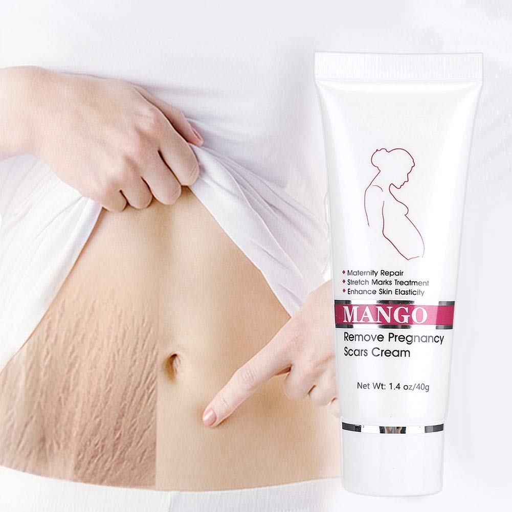 Stretch Mark Cream, Scar Cream Removal Cream Scars Essence Stretch Mark Repair Cream Stretch Scars Remove Acne Cream Stretch Mark Treatment Maternity Repair