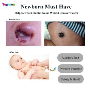 Topwon 10 Pcs Baby Belly Band Newborn Belly Binder Infant Umbilical Cord Band Belly Button Warp Registry Must Haves Gift Cotton