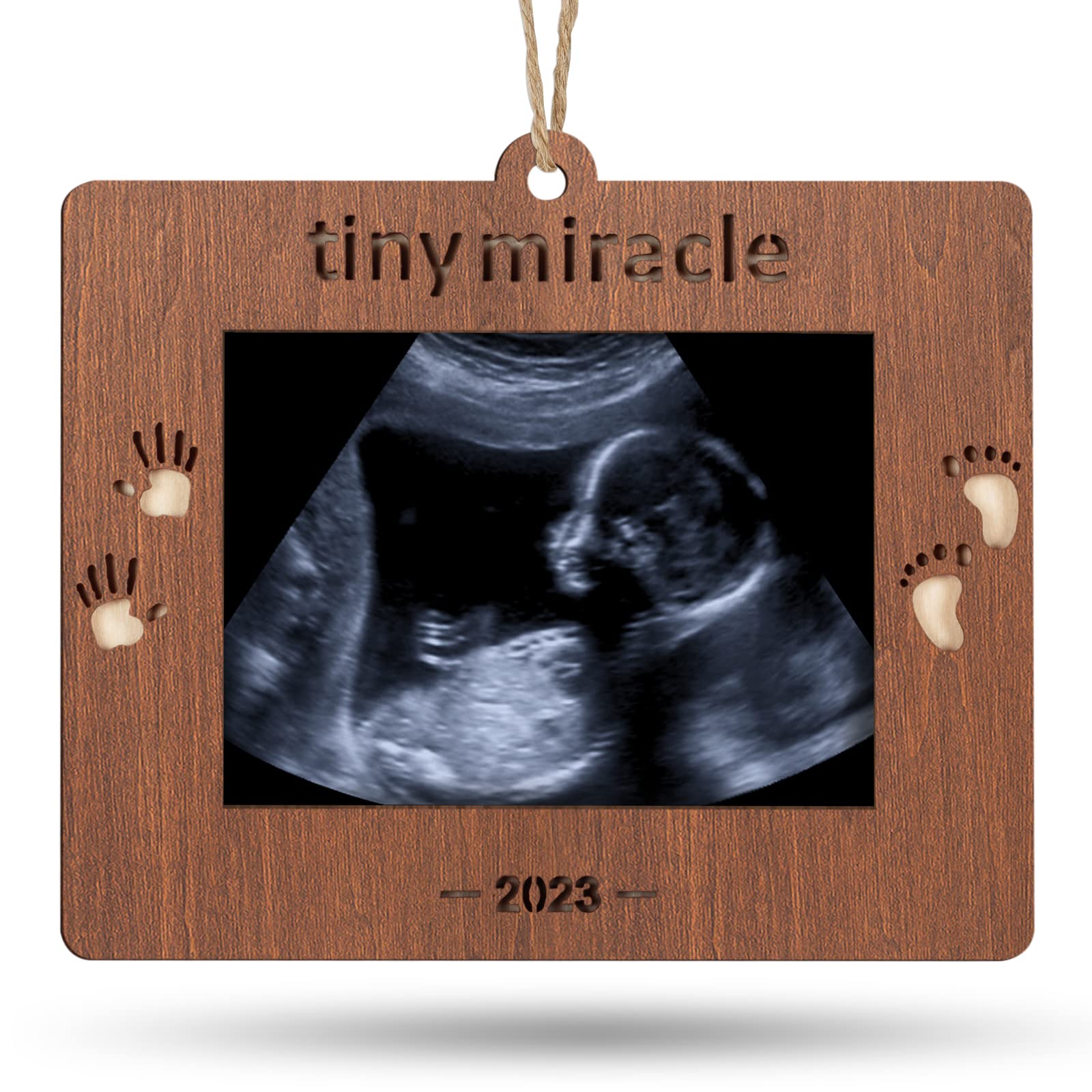 Creawoo 2023 Tiny Miracle Christmas Ornament Sonogram Picture Frame Baby's First Christmas Baby Gift Ultrasound Photo Frame Tiny Miracle Keepsake for Expecting Parents and Grandparents