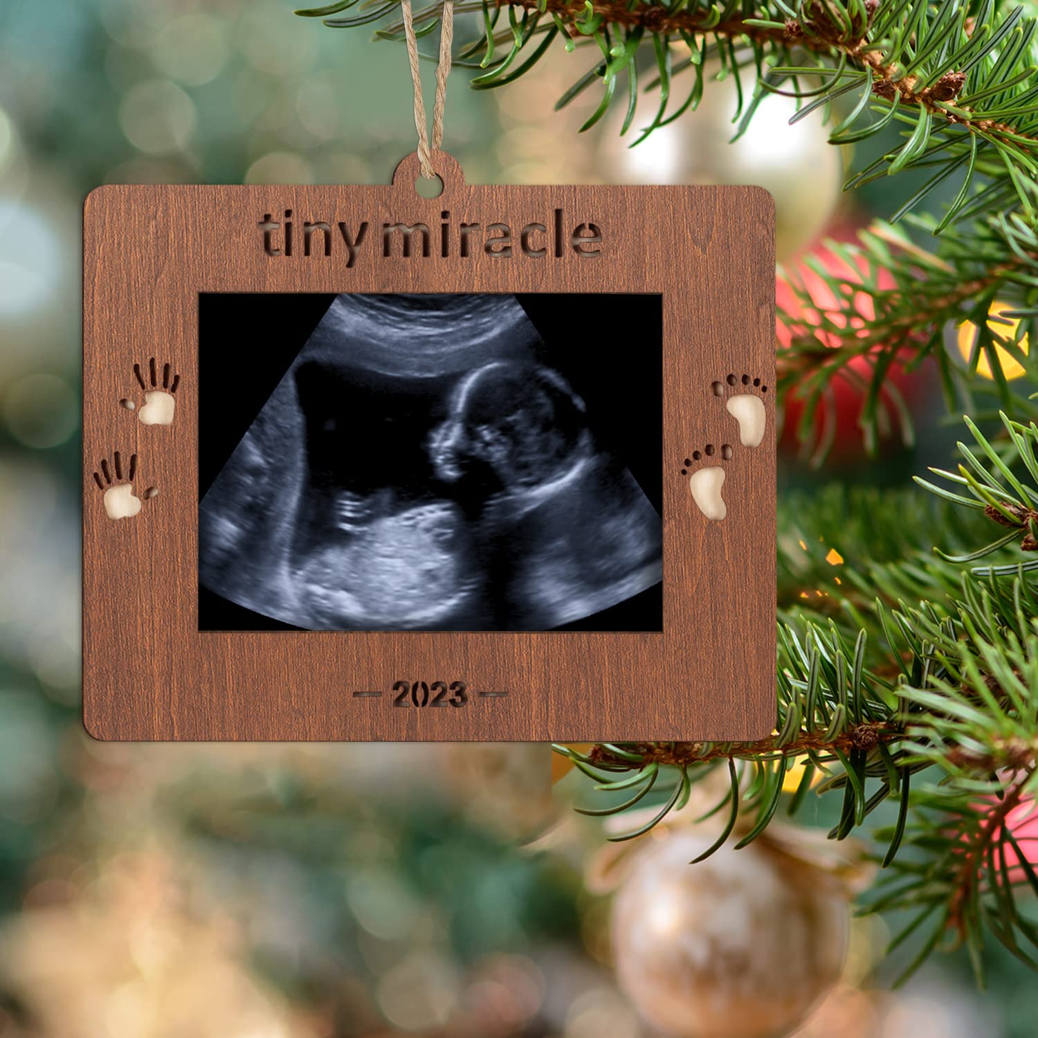 Creawoo 2023 Tiny Miracle Christmas Ornament Sonogram Picture Frame Baby's First Christmas Baby Gift Ultrasound Photo Frame Tiny Miracle Keepsake for Expecting Parents and Grandparents