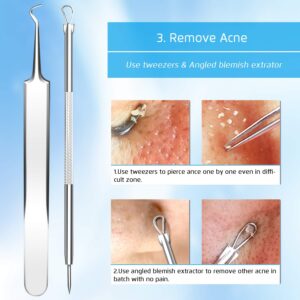 Premium Blackhead Remover, Comedone Blemish Acne Extractor,Popping Pimple Popper Whitehead Removal, Precision Tweezers, Zit Removing, Milia Remove