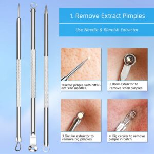 Premium Blackhead Remover, Comedone Blemish Acne Extractor,Popping Pimple Popper Whitehead Removal, Precision Tweezers, Zit Removing, Milia Remove