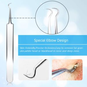 Premium Blackhead Remover, Comedone Blemish Acne Extractor,Popping Pimple Popper Whitehead Removal, Precision Tweezers, Zit Removing, Milia Remove