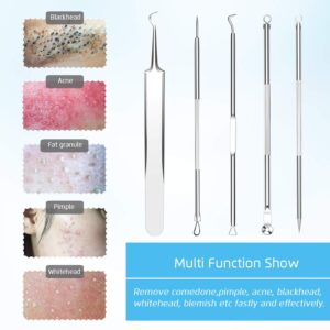 Premium Blackhead Remover, Comedone Blemish Acne Extractor,Popping Pimple Popper Whitehead Removal, Precision Tweezers, Zit Removing, Milia Remove