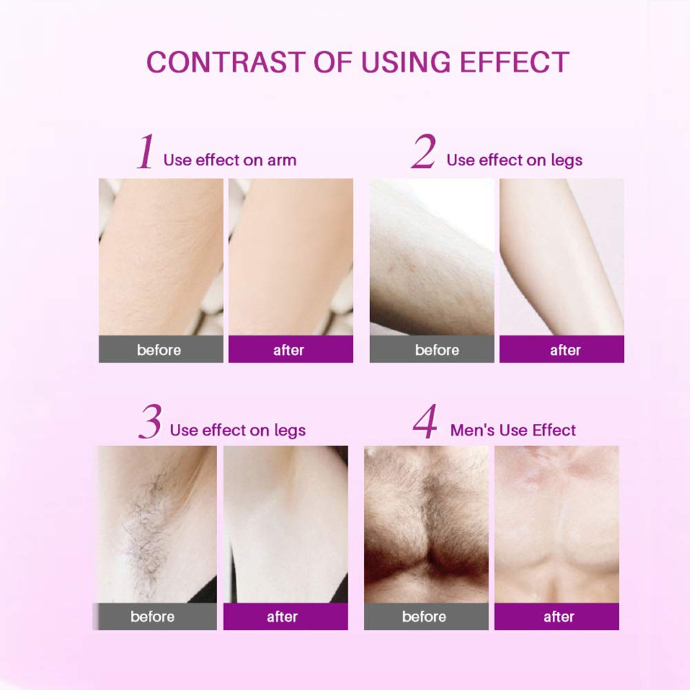 Women Hair Removal Foam Mousse, Natural Painless Permanent Spray Body Depilatories Gel Cream For Women Body Hair Foam Mousse Creams Depilatories