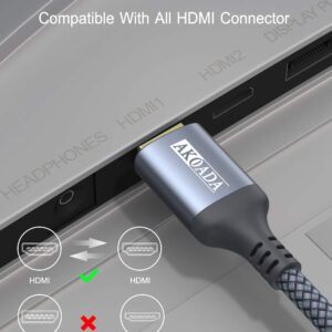 AkoaDa 4K HDMI Cable 6.6FT, 18Gbps High Speed HDMI 2.0 Braided Cable, Supports 4K 60Hz, 2K, 1080P, HDCP2.2 Compatible with Roku/Fire TV/PC/PS5/4/X-Box