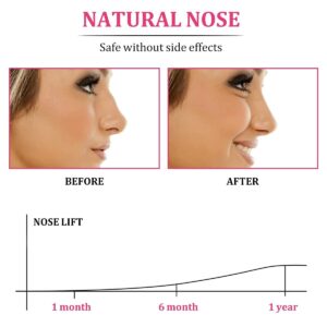 Nose Shaper, Invisible Nose Up Lifting Nose Lifting Shaping Clip Nose 0 Straightening Beauty Tool for Kit Clip Corrector