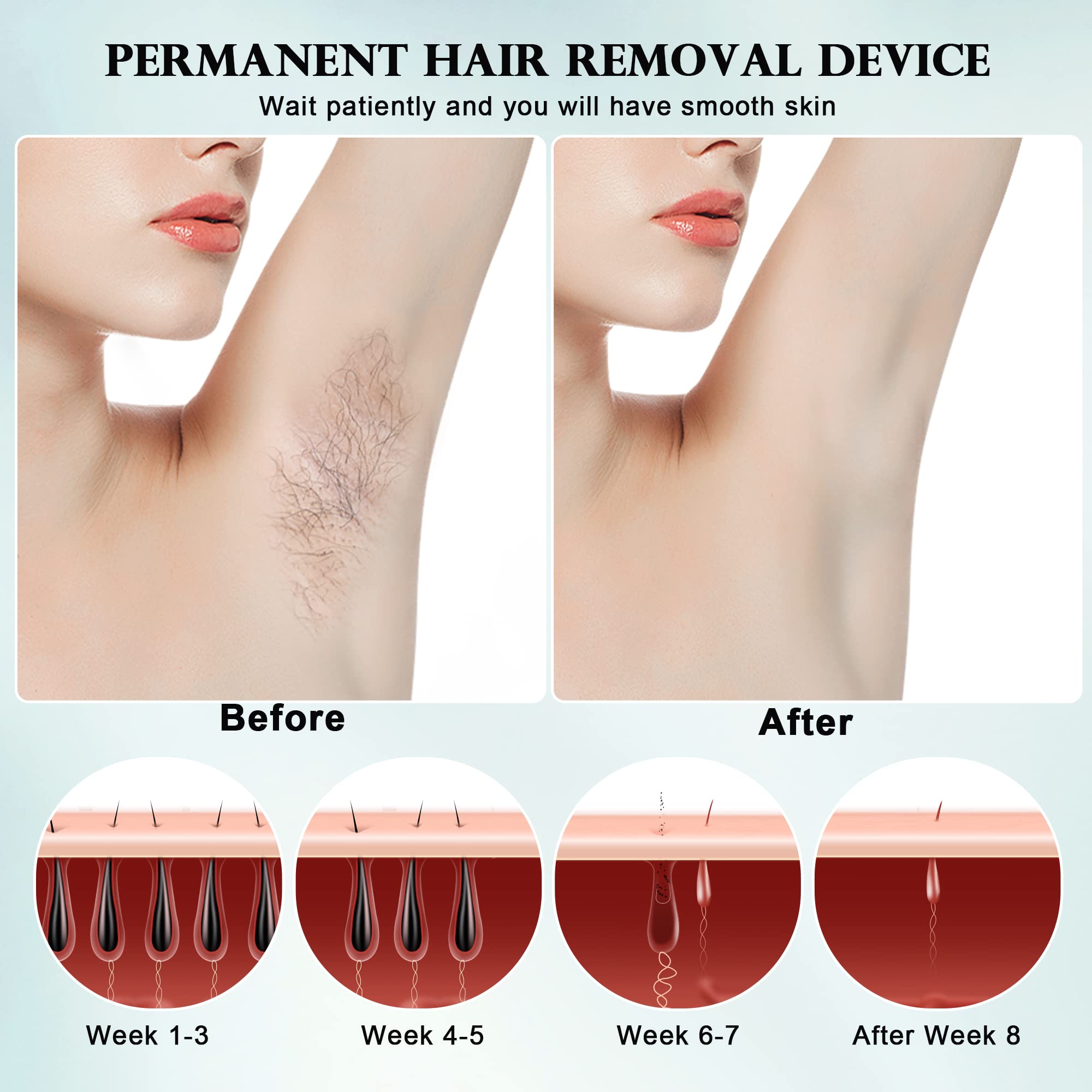 DEESS IPL Laser Hair Removal with ICE Freezing Point Cooling System, Unlimited Flashes at-Home Permanent Hair Removal Device for Women and Men, Long-lasting Reduction of Body & Face Hair Regrowth