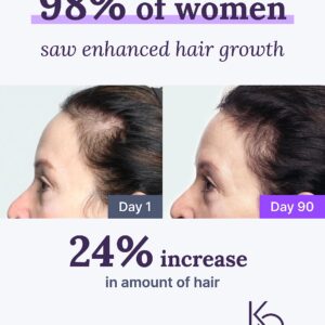 Keranique Hair & Scalp Supplements - Promote Strength and Growth Best for Thinning Nourish Your with Biotin, Vitamin B, More Vital Nutrients Keraviatin