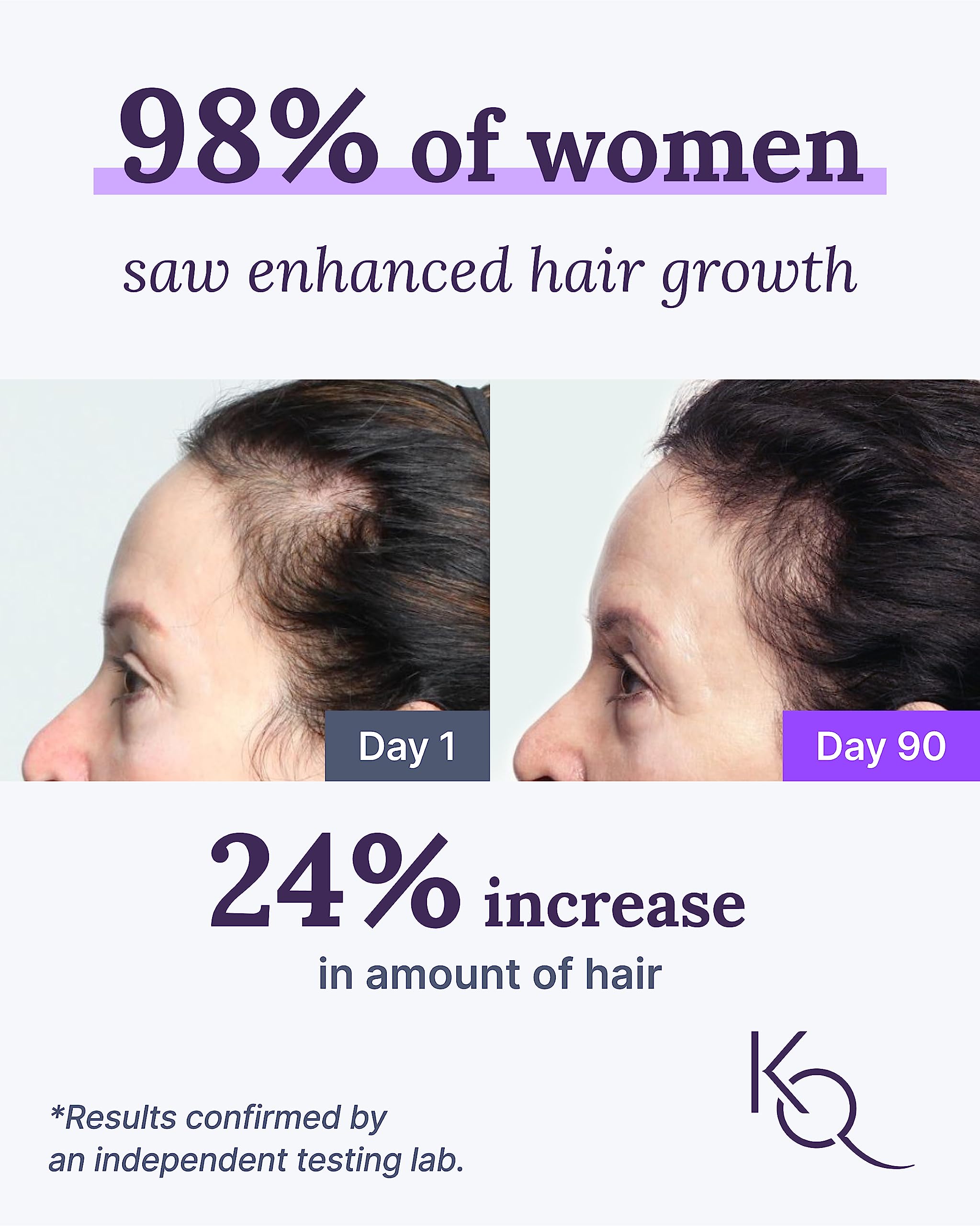 Keranique Hair & Scalp Supplements - Promote Strength and Growth Best for Thinning Nourish Your with Biotin, Vitamin B, More Vital Nutrients Keraviatin