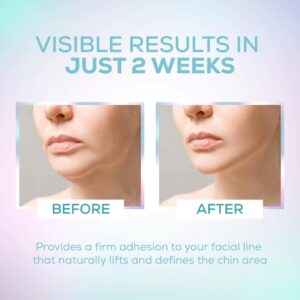 VENUS VISAGE V-Line Chin Mask, Moisturizing Double Chin Mask for Jaw Line Definition, Chin Strap for Double Chin for Women & Men, V Line Lifting Mask, Visually Sculpting Double Chin Strap (5-Pack)